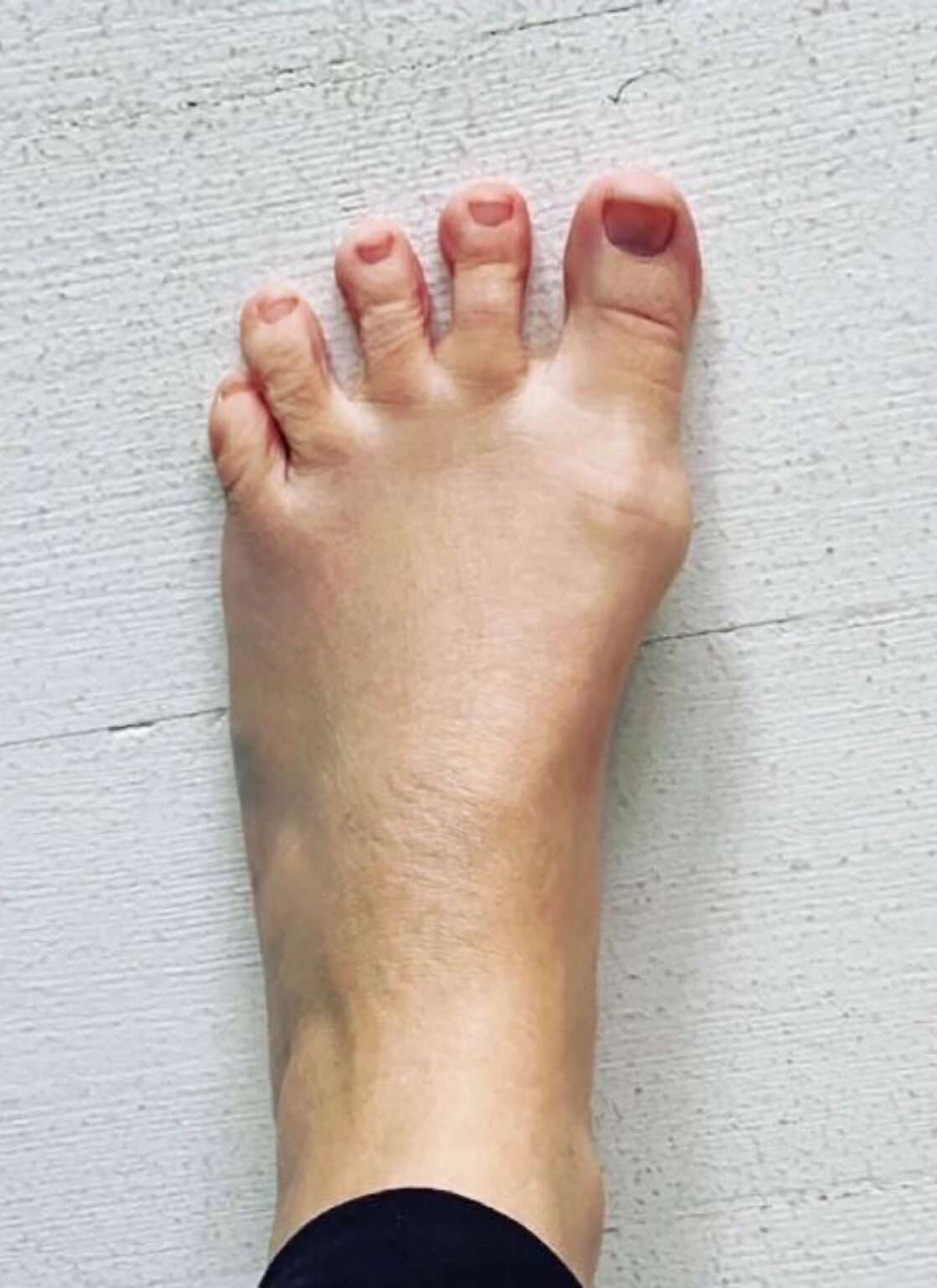 The Importance of Toe Mobility and Strength | Verity Bell - Yoga, Gait ...